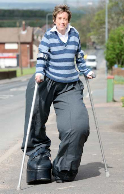 Me,Myself and I: Mandy Sellars: The woman with giant legs