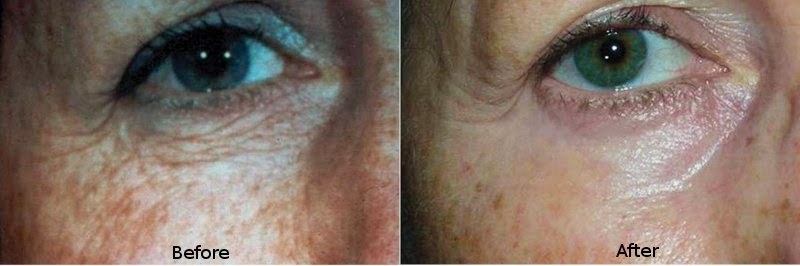 Beautiful Inside and Out: What causes pigmentation and how can it be ...