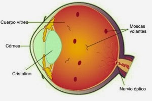 Miodesopsias Causas y síntomas: Causas de las miodesopsias o moscas ...