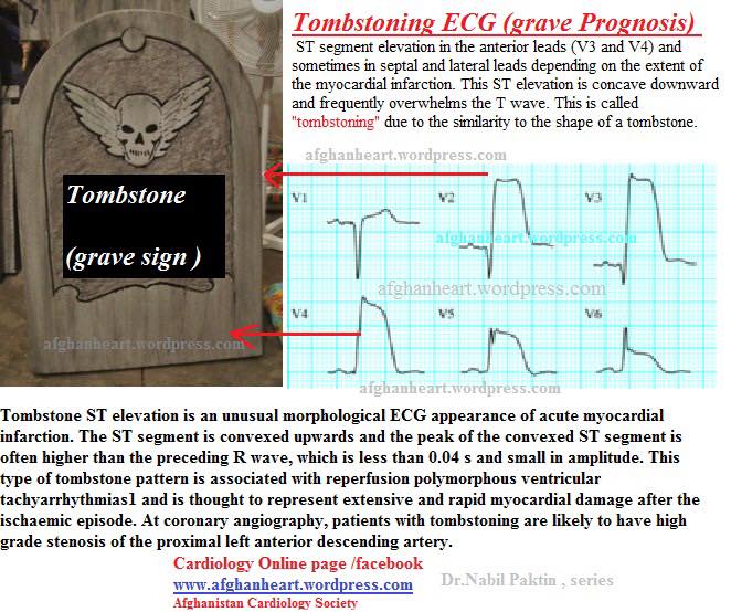 Dr.Nabil Paktin's Cardiology Blog مجله کاردیولوژی دکتور نبــیل پاکطـین ...