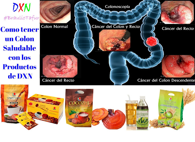 Colon Saludable con los Productos de Dxn - DXN - Oportunidad de Iniciar ...