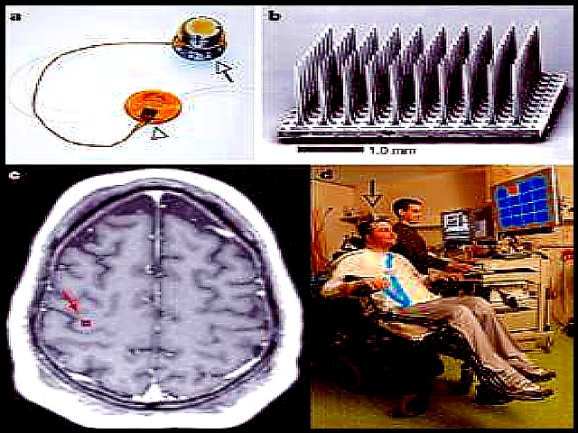 Targeted Individuals Canada: Human Brain Implant Research Suspended At ...