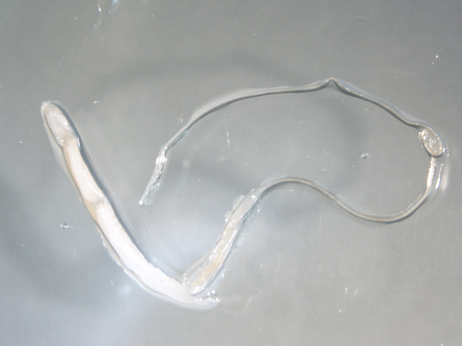 Creepy Dreadful Wonderful Parasites: Case of the Week 405