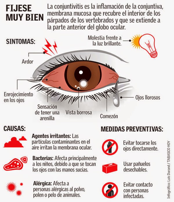 OPTICA VISIÓN & SOL : Conjuntivitis Pediátrica