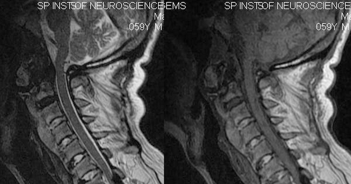 Dr Balaji Anvekar FRCR: DISH