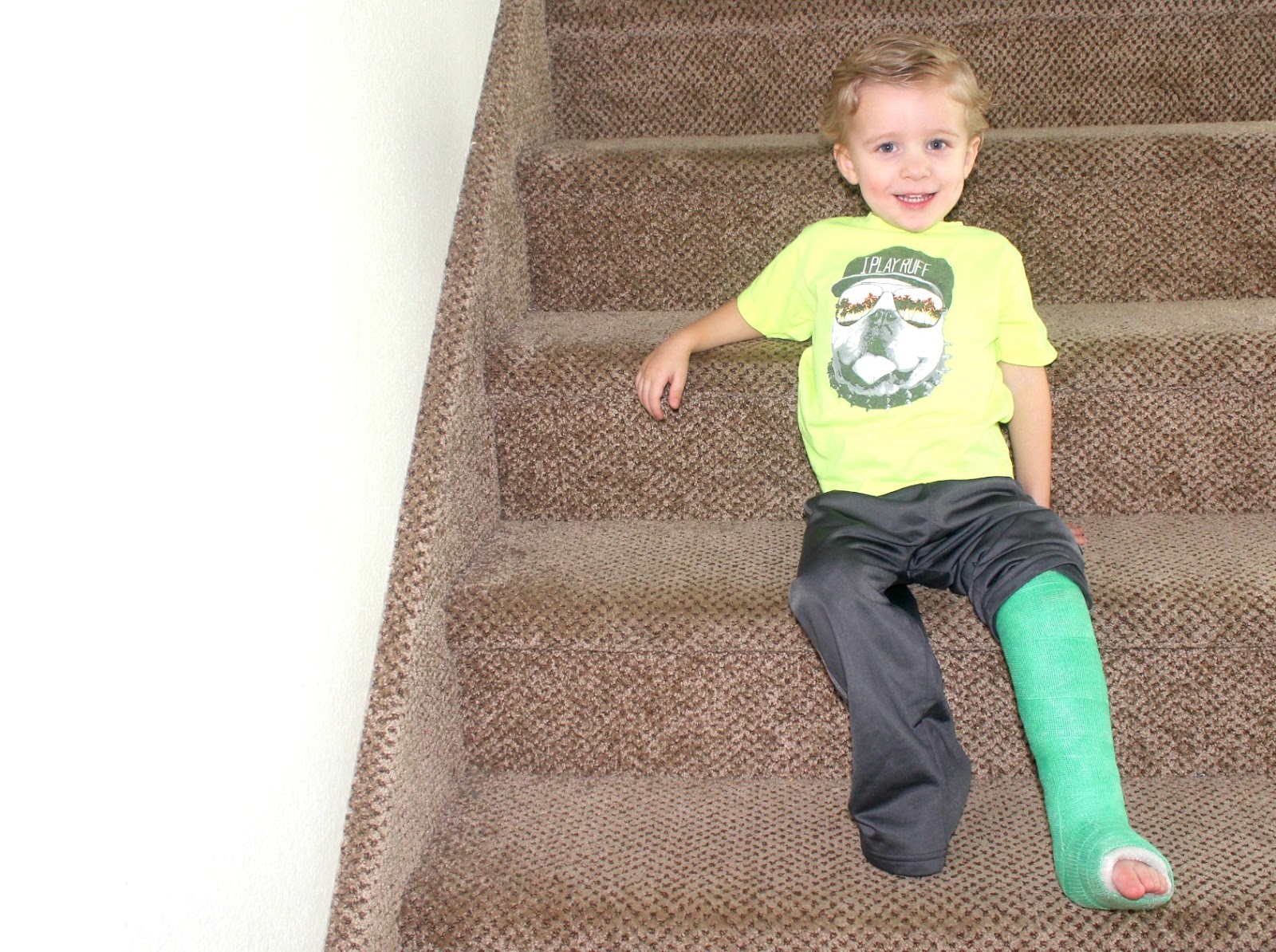 Our first broken bone... I'm sure the first of many. | The Sullengers