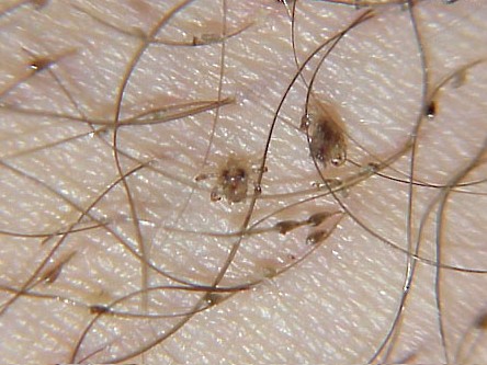 Medische Kennis: Soa-consult