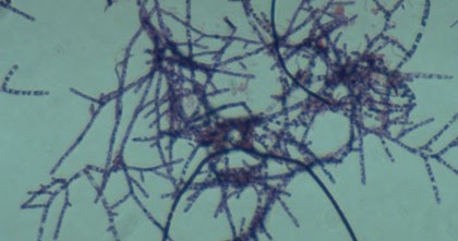 Actinomycetes