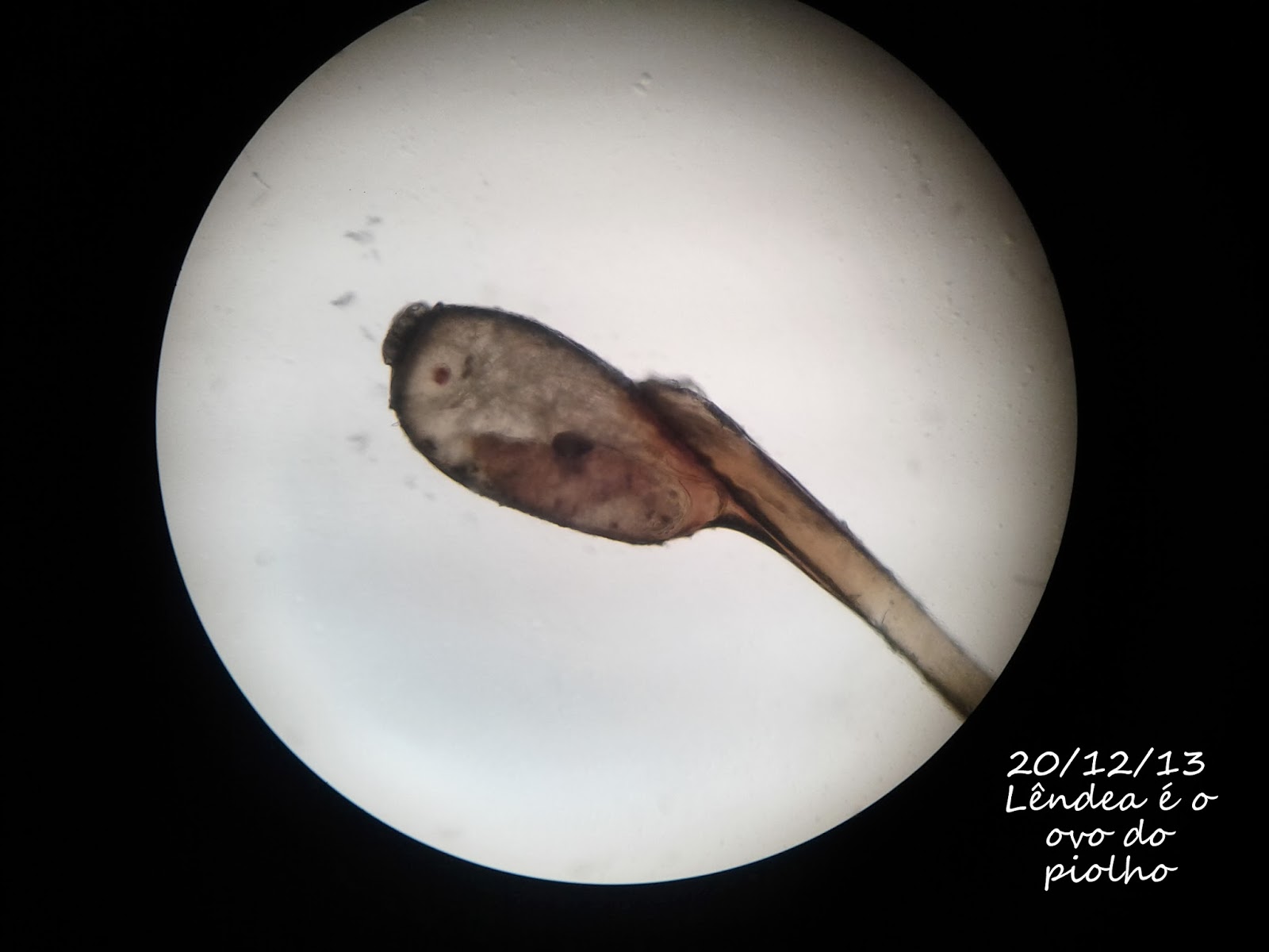 Piolhos: Imagens e vídeos no microscópio - Diário de um Cientista