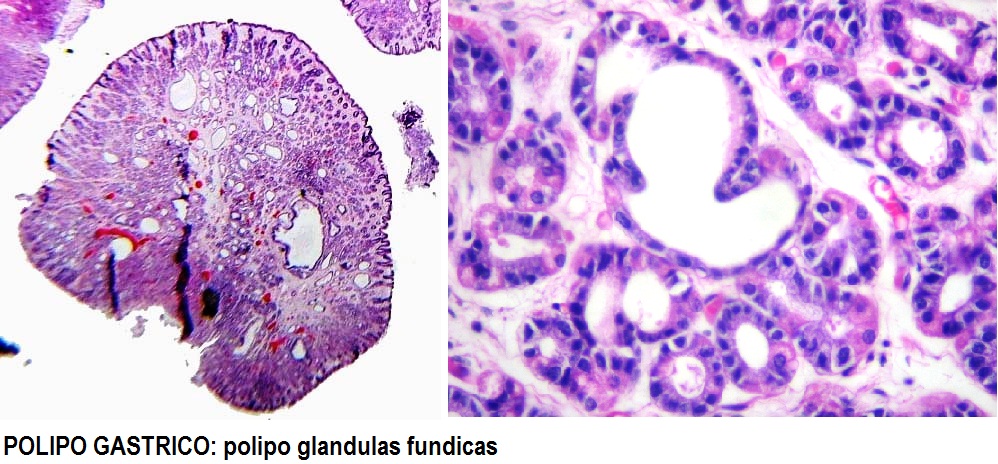 GASTROINTESTINAL AND LIVER HISTOLOGY PATHOLOGY ATLAS: STOMACH: FUNDIC ...