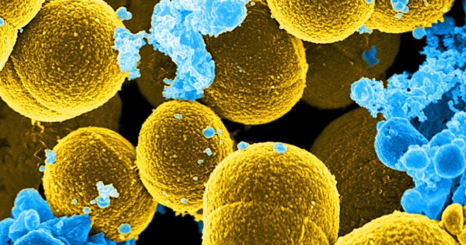 career: A New Antibiotic Multitool Could Beat The Toughest Bacteria 06-06