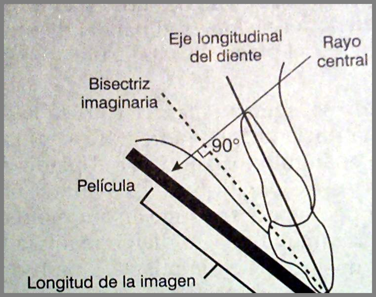 Imagenologia: TECNICAS DE BISECTRIZ Y PARALELISMO