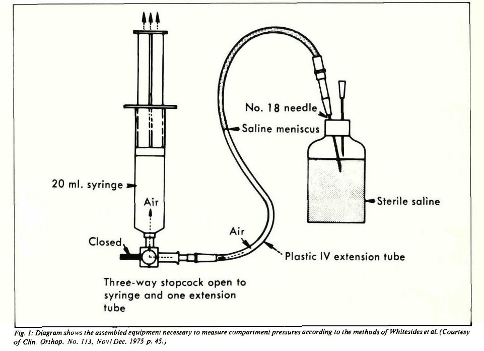 ER goldbook: Compartment syndrome