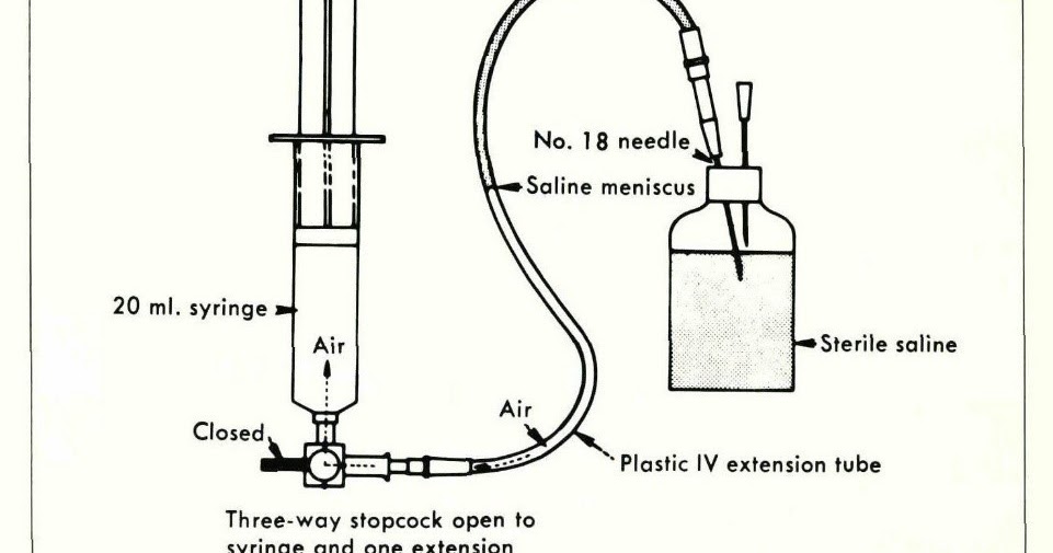 ER goldbook: Compartment syndrome