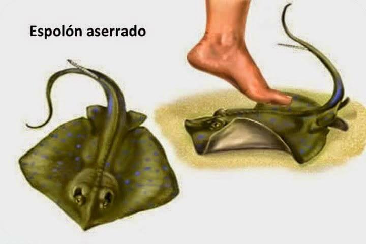 Picadura de Raya - Que hacer - Region Litoral