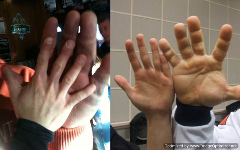 Arm Wrestler Jeff Dabe’s Massive Hands | Bodybuilding and Fitness Zone