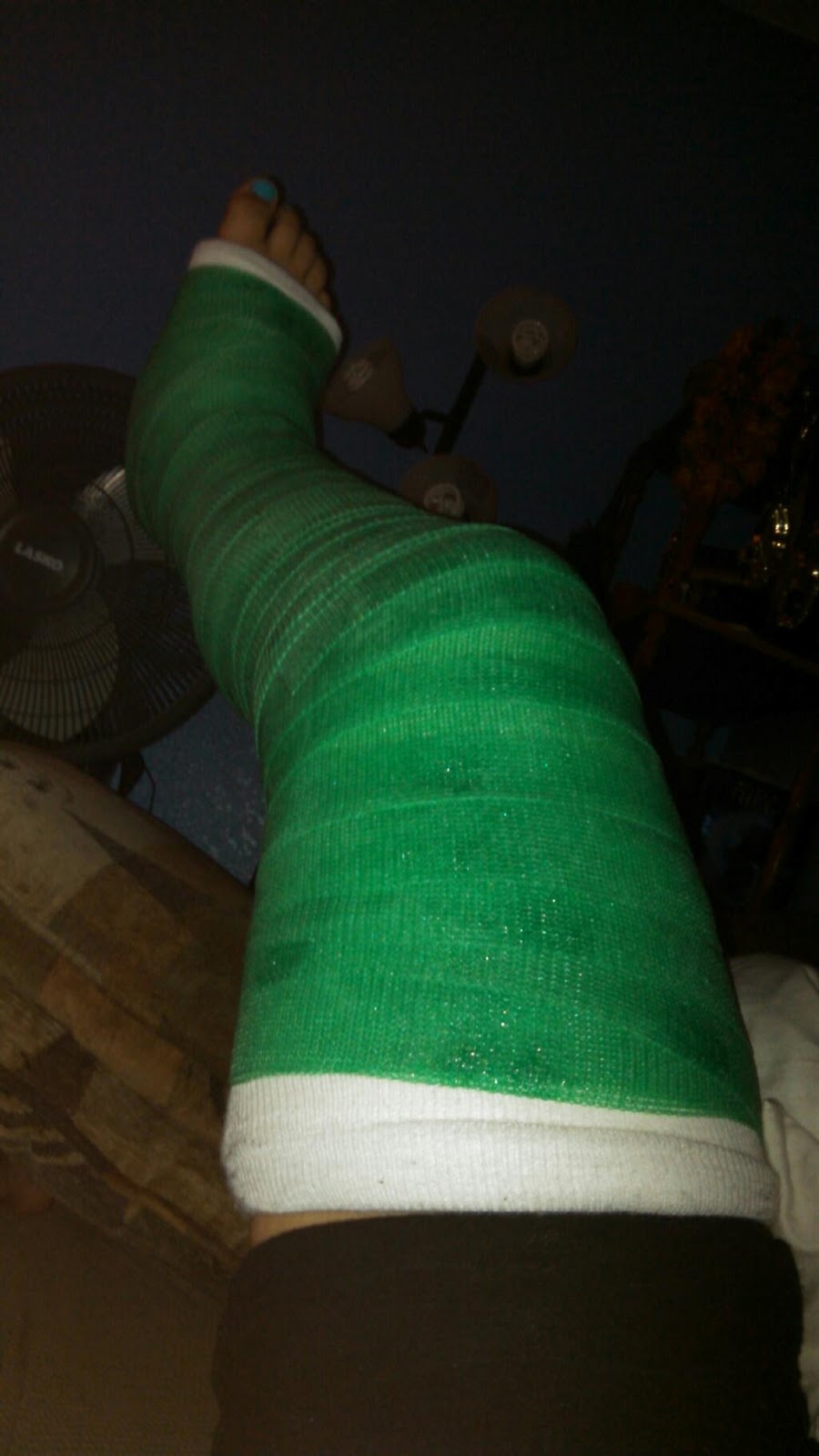 Casts and Toes: Random Full Leg Cast Pics