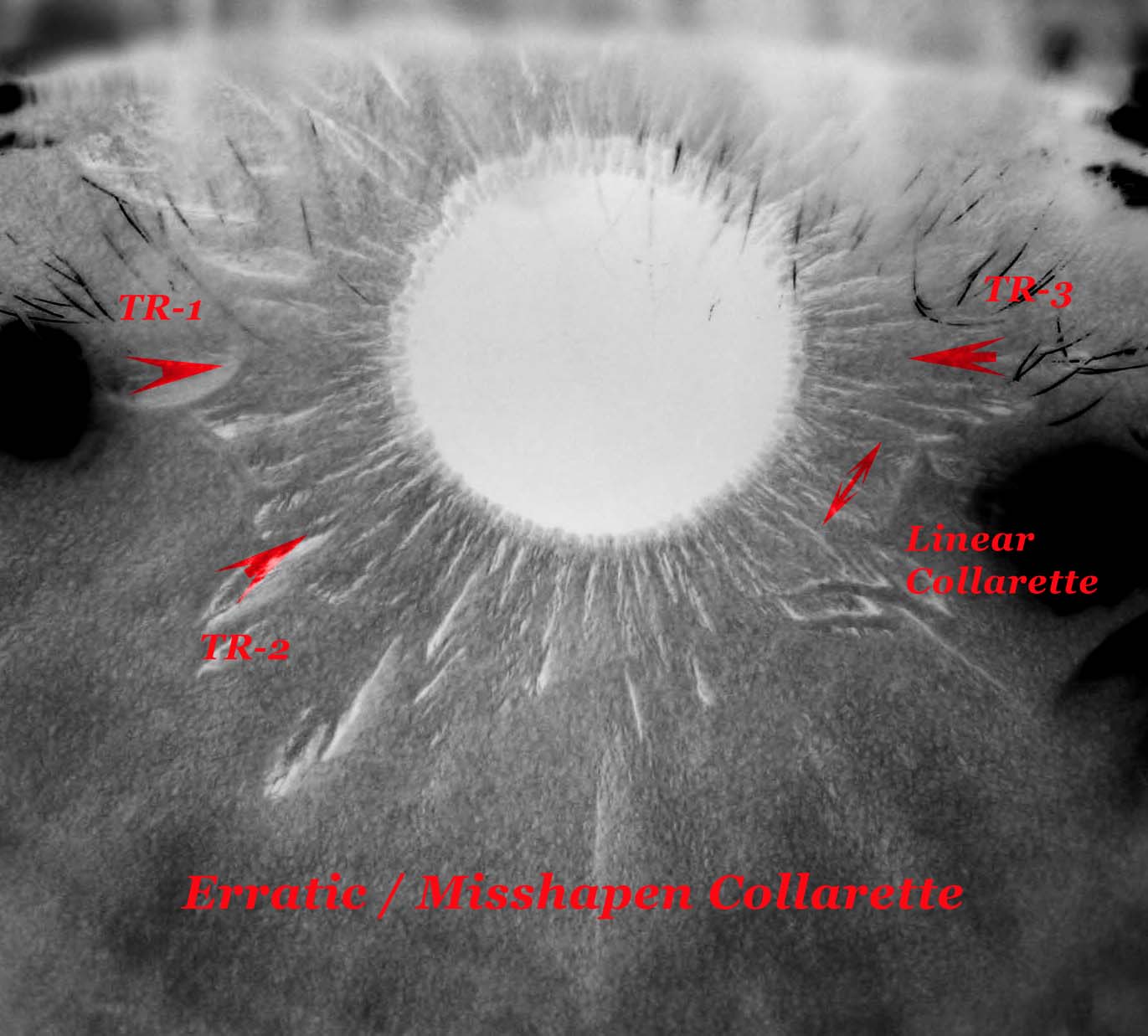 Modern & Multidimensional Iridology: Erratic / Misshapen Collarette ...