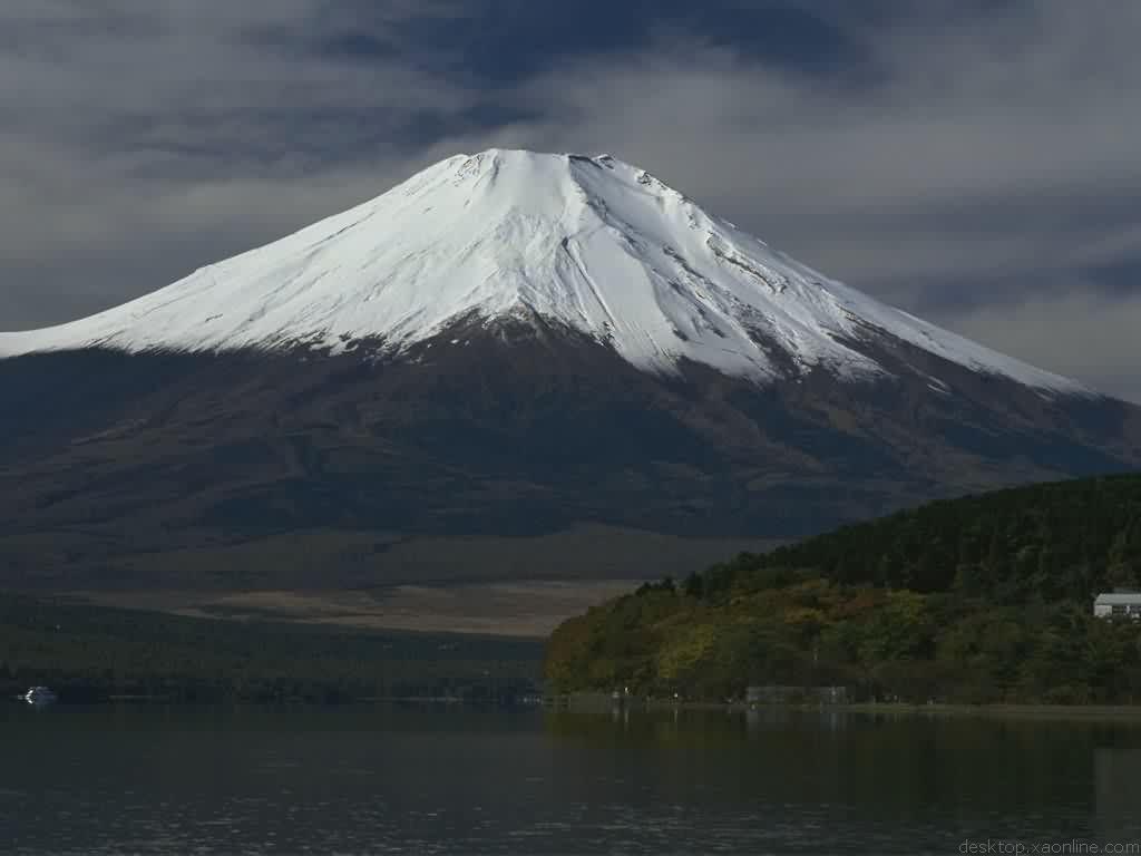ABC Radiology Blog: The Mount Fuji Sign