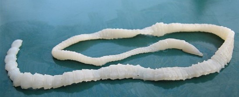 Terviseakadeemia uus hingamine- uus elu: Paeluss võib põhjustada: