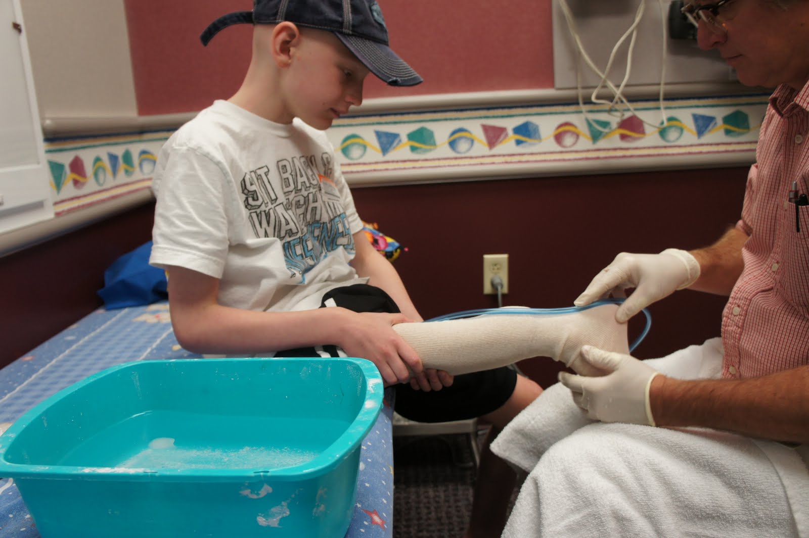 Rotationplasty Video