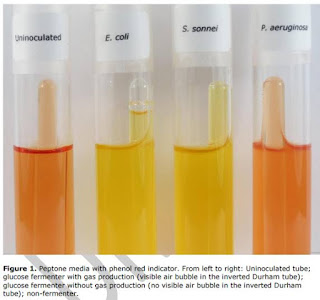 Phenol Red Fermentation Test – Principle, Procedure, Uses and ...