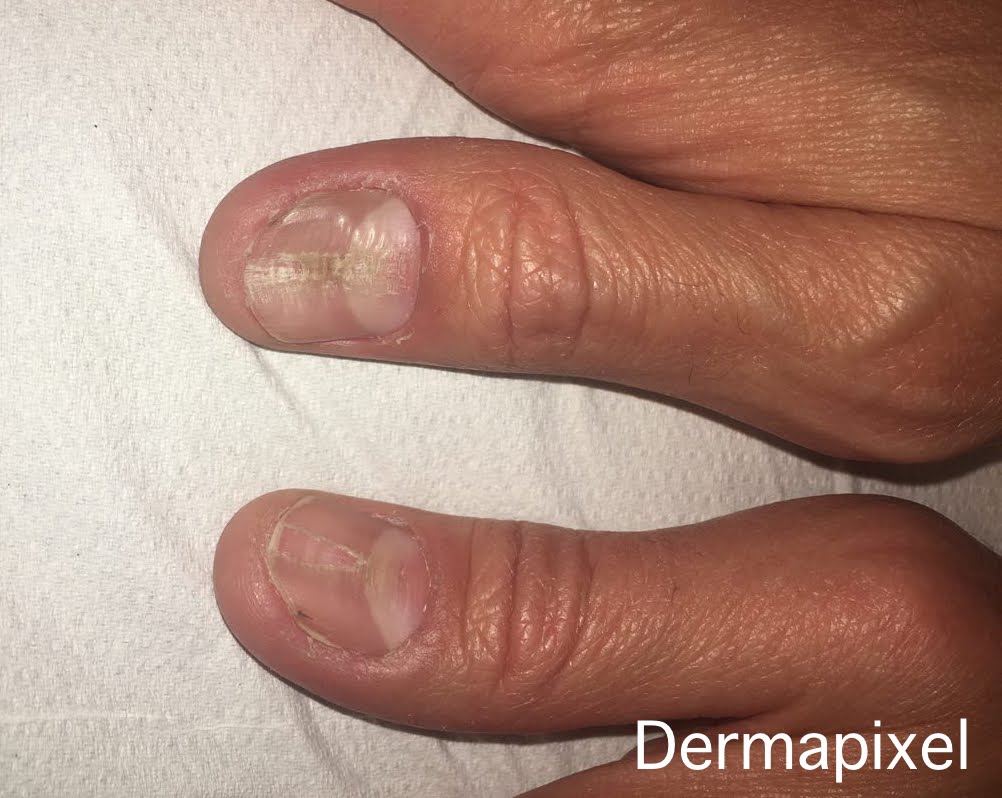 Dermapixel: abril 2019