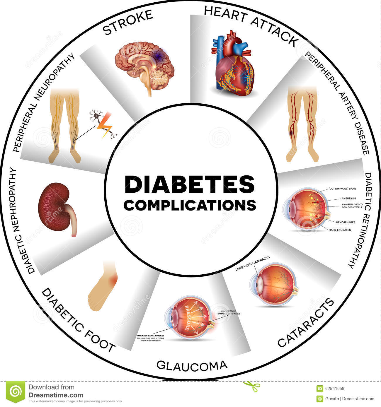 ¿Qué es la Diabetes Mellitus? ~ DIABETES MELLITUS