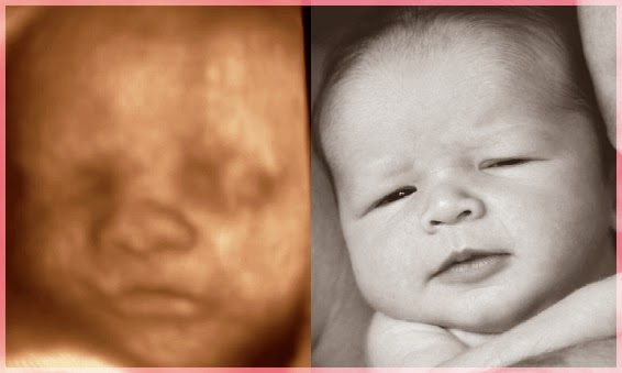 NADI IMAN MEDICAL 0351919657: PERKHIDMATAN SCAN 3D4D MURAH & BERBALOI