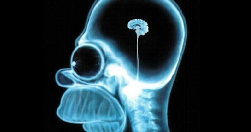 SRI LANKA: A BRAINLESS HEAD | Sri Lanka Guardian