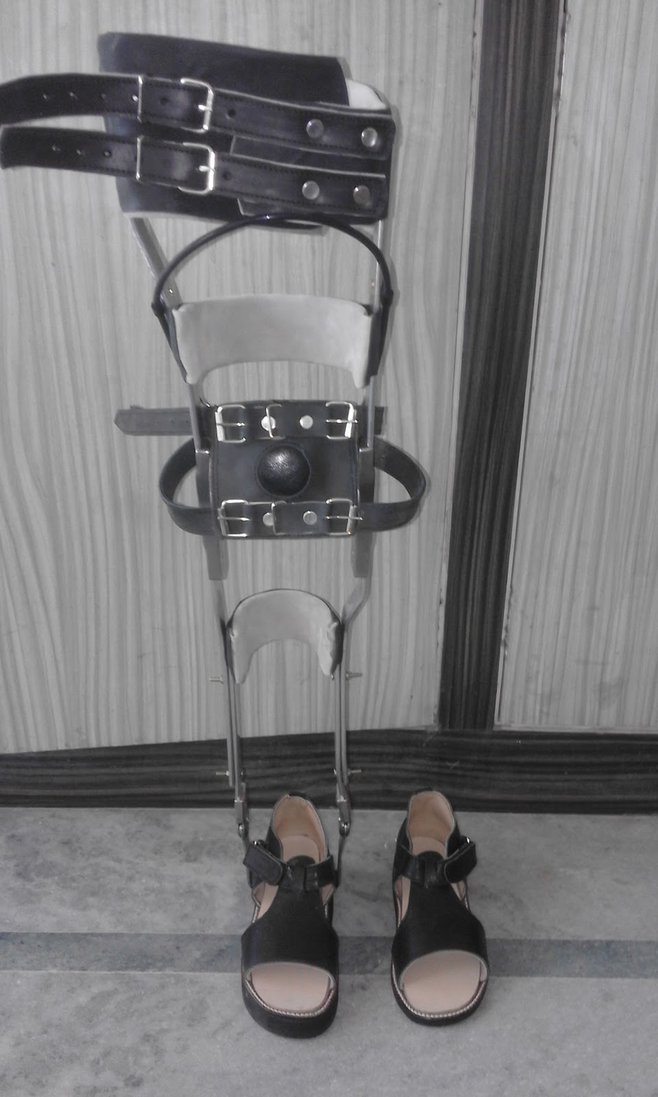 Prosthetics & Orthotics from My Care: Calipers for Polio Patients (KAFO)