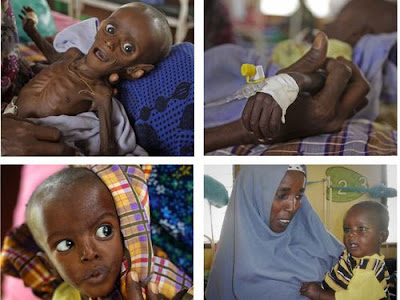 Conselho Tutelar de Lagoa Nova - RN: Bebê desnutrido que comoveu o ...