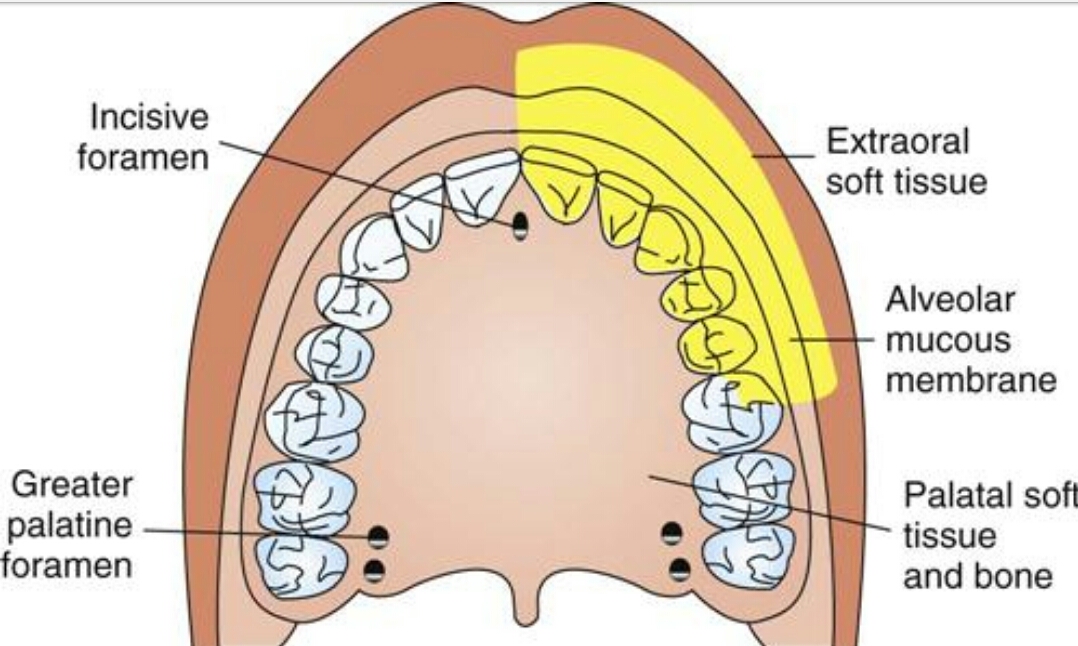 Cpt For Infraorbital Nerve Block
