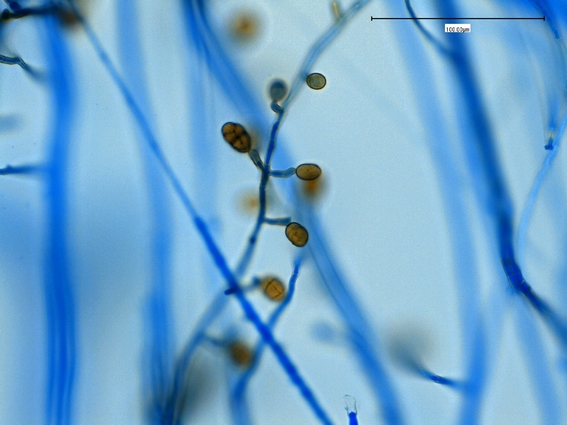 Fun With Microbiology (What's Buggin' You?): Stemphylium species