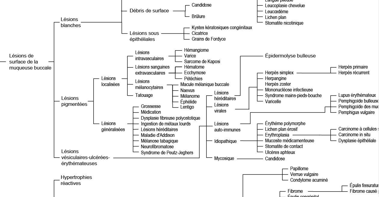 Dentist art : Arbre décisionnel pour les lésions de la muqueuse buccale