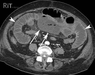 RiT radiology: February 2011