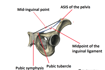 Testicular cancer : inguinal canal and orchidectomy