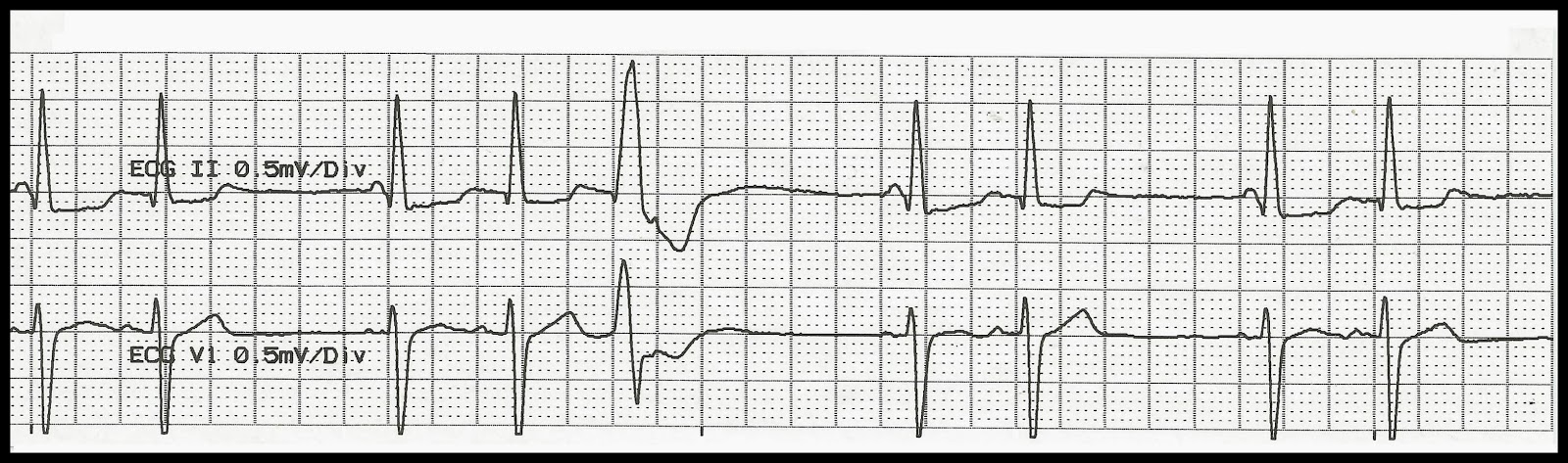 EKG Rhythm Strip Quiz 189