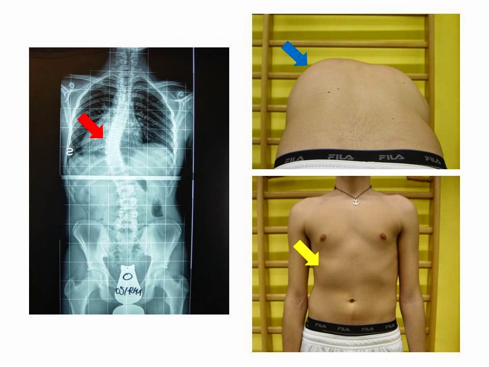 De Arte Gymnastica: "COME CI ACCORGIAMO SE NOSTRA/O FIGLIA/O HA LA ...