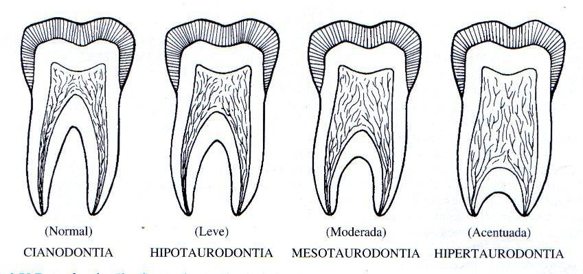 ESTUDONTO: Distúrbios de desenvolvimento dos dentes