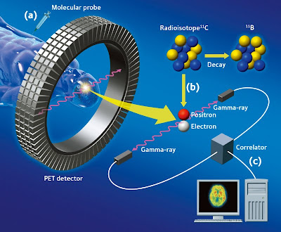 Molecular Imaging Making Headway Into Developments In Disease Treatment ...