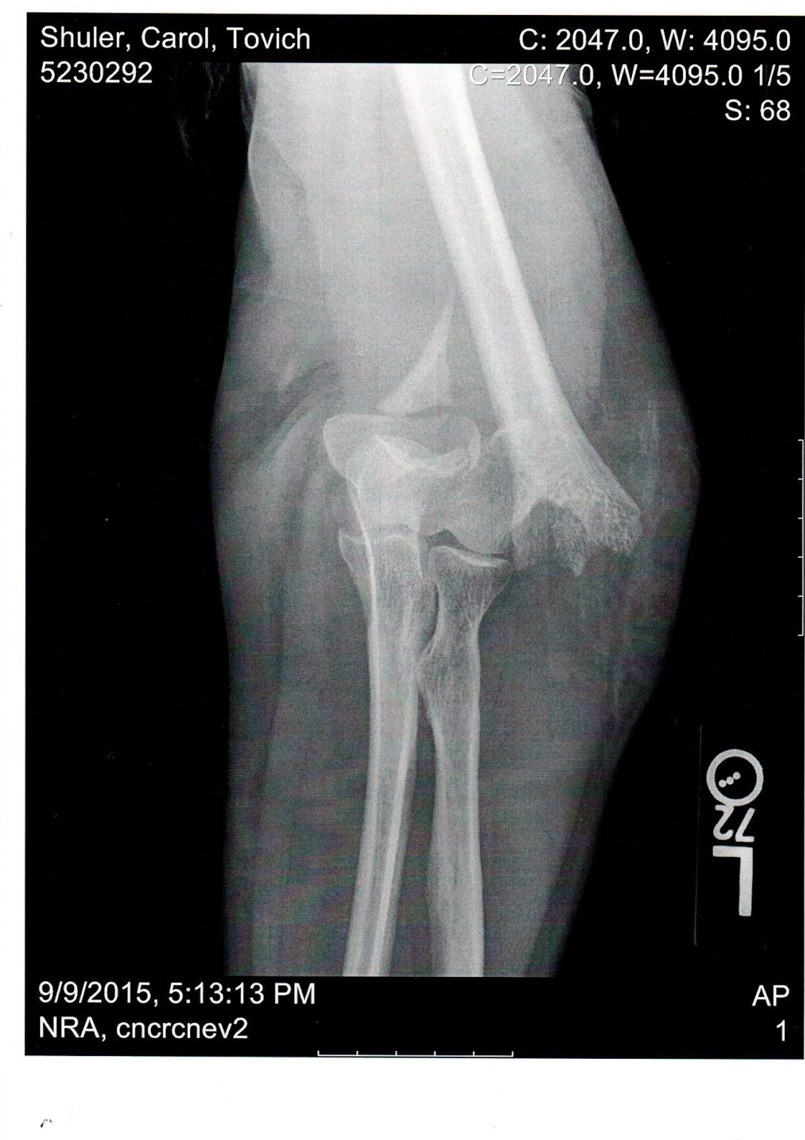 Legal Schnauzer: Did Missouri sheriff Jim Arnott concoct a "cover ...