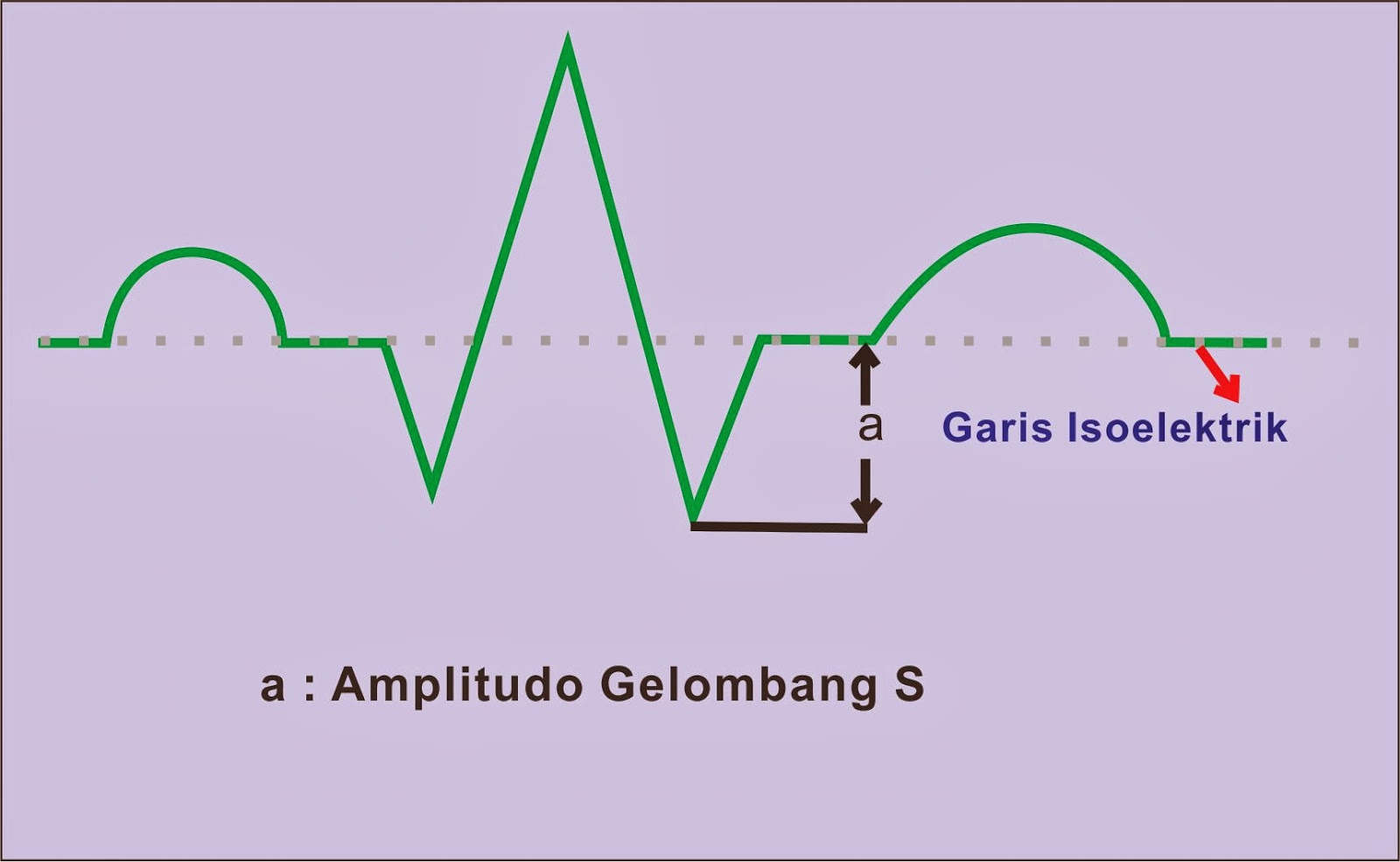 Gelombang pada EKG