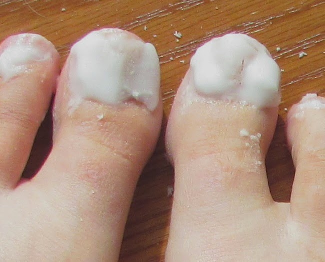 As Seen on Pinterest: Baking Soda and Peroxide Nail Whitener