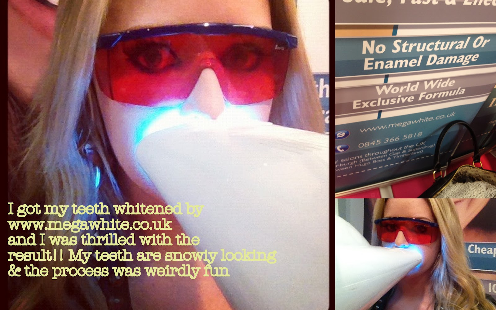 Lipstick Gossip by: Megawhite Teeth whitening - Tried and tested!