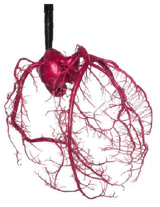 Angst efter blodprop i hjertet: Hvad er AMI