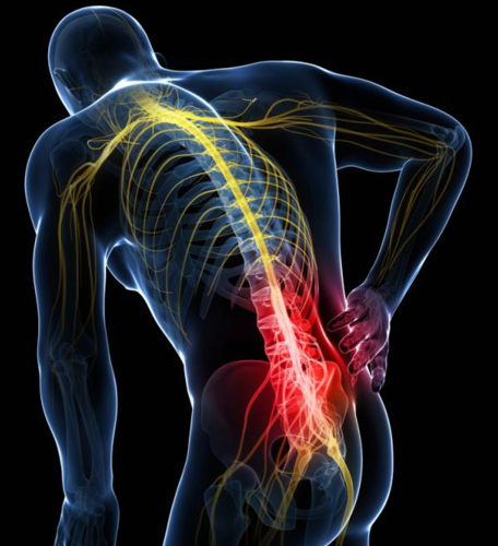 .: Cara Mengurangkan Sakit Slipped Disc