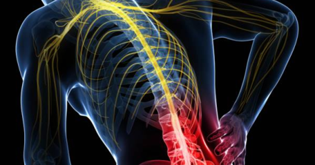 .: Cara Mengurangkan Sakit Slipped Disc