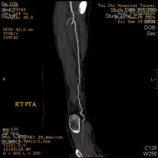 淨元法師之大醫院小醫師: Right PTA