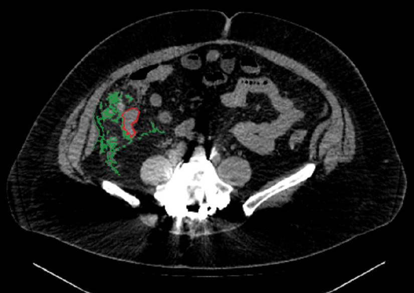 Radiology Case of the Day: 2017